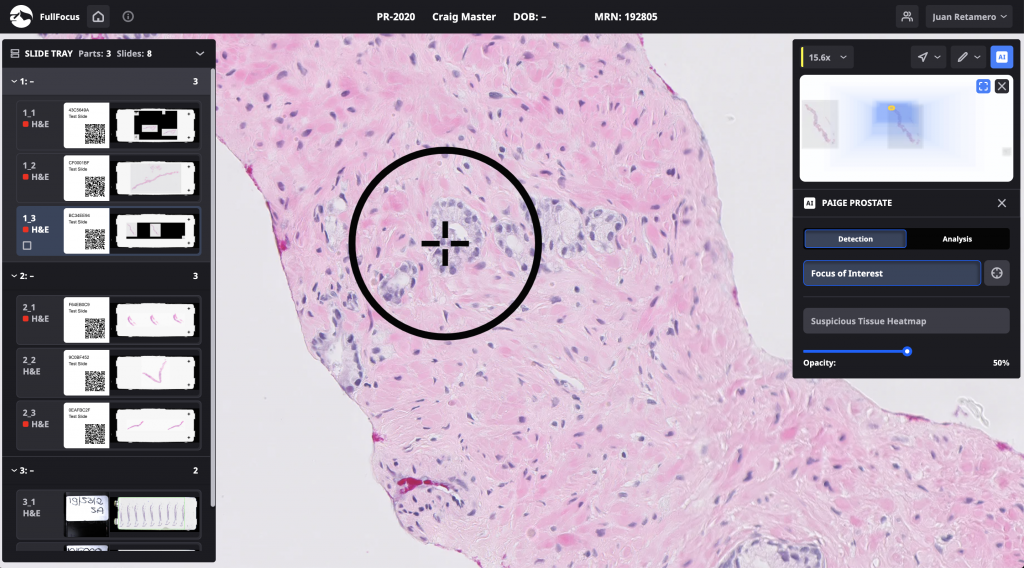 Paige Prostate Detect - Sectra Amplifier Marketplace