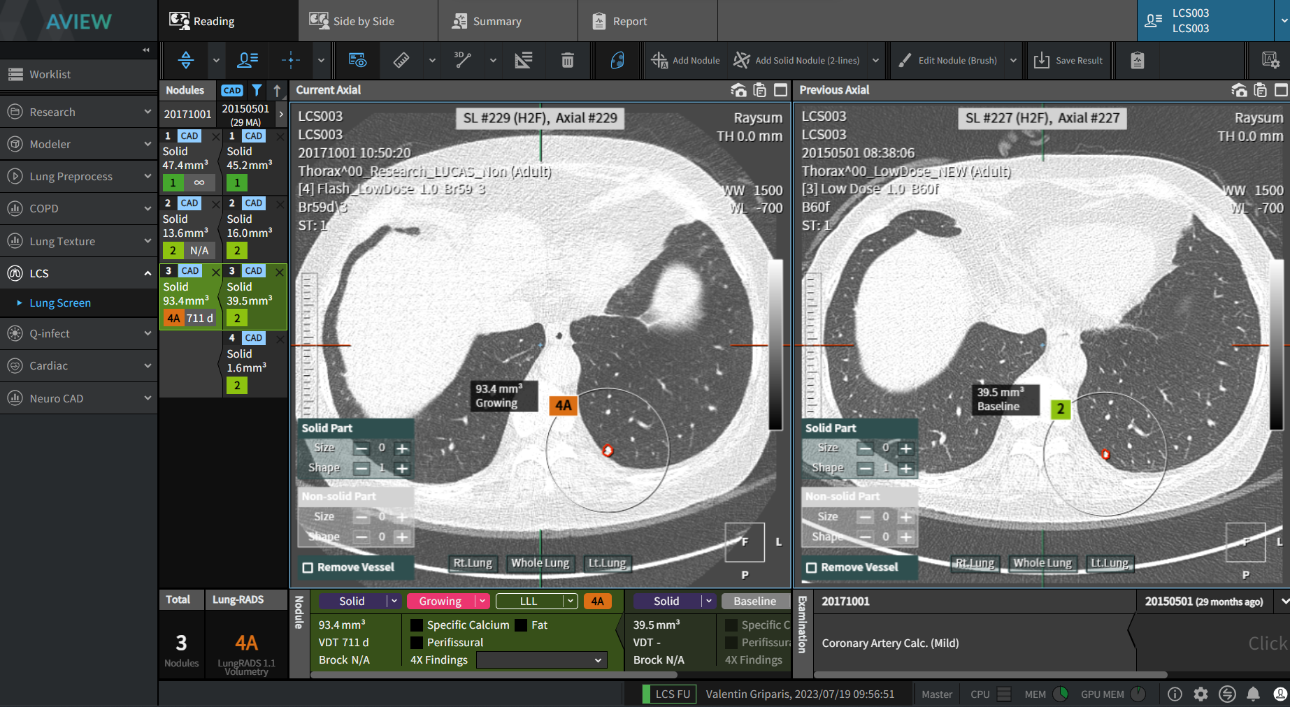 AVIEW LCS+ - Sectra Amplifier Marketplace