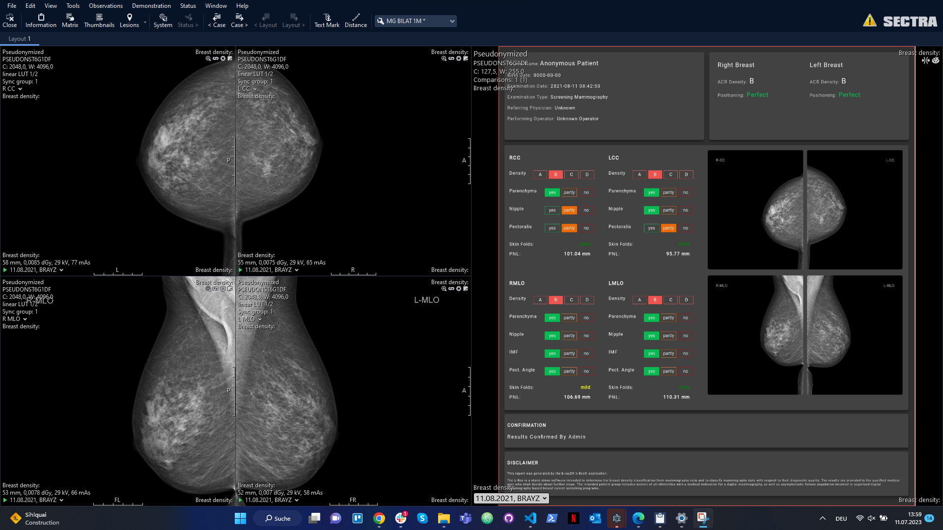 b-box - Sectra Amplifier Marketplace