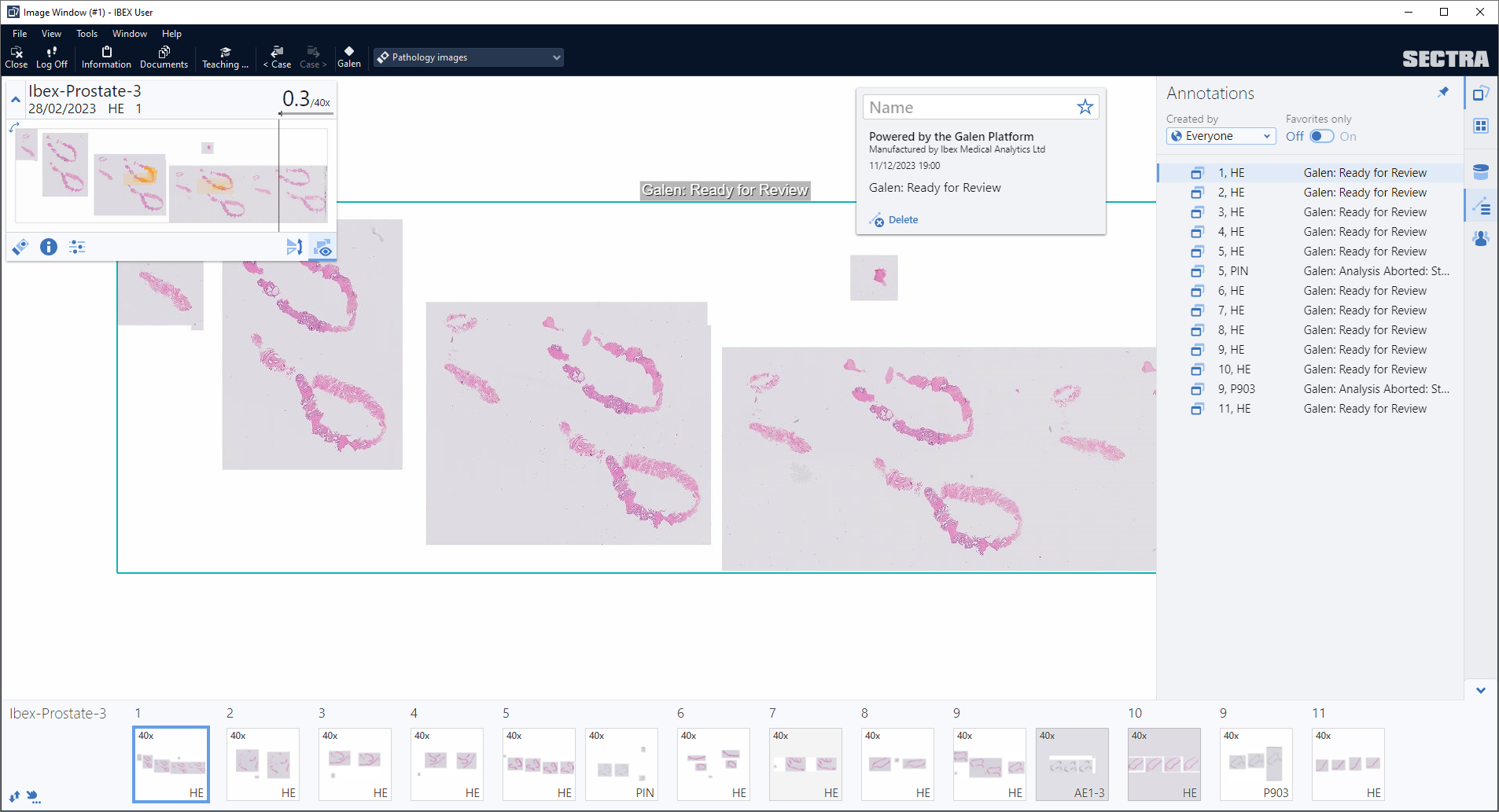 Ibex Gastric - Sectra Amplifier Marketplace