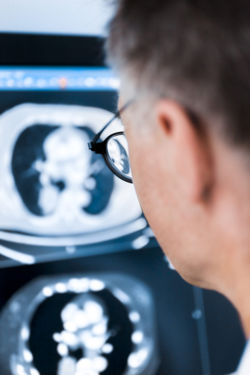Four areas where radiology can improve cancer care | Sectra Medical