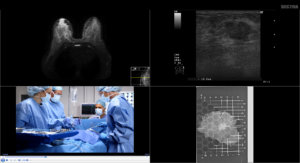 Sectra Breast Imaging PACS and RIS | Sectra Medical