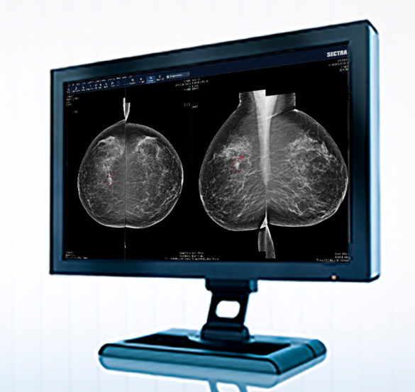 Sectra Breast Imaging PACS and RIS | Sectra Medical