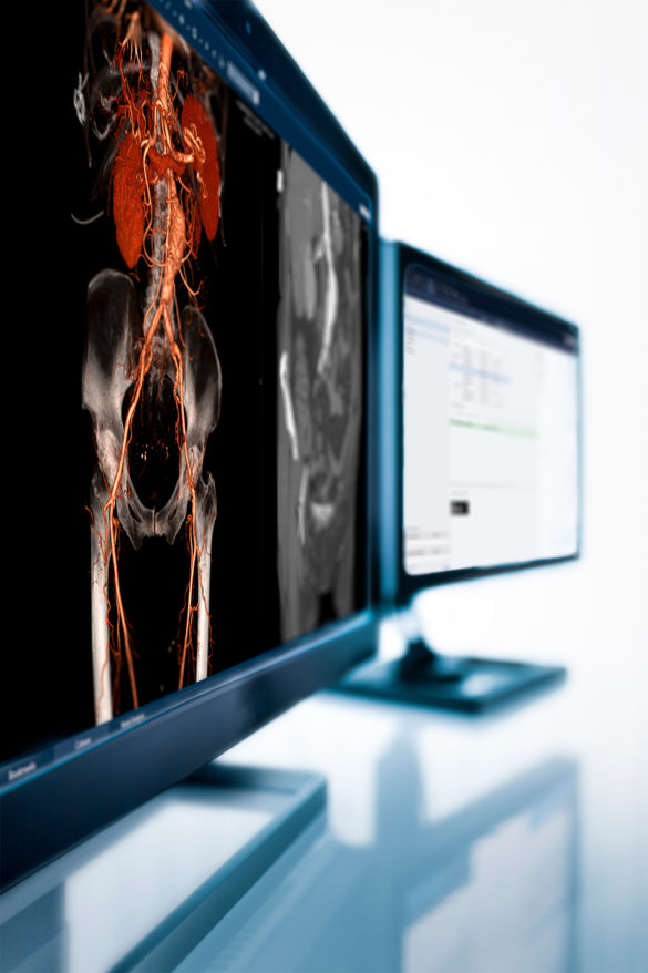 Radiology imaging | Sectra Medical