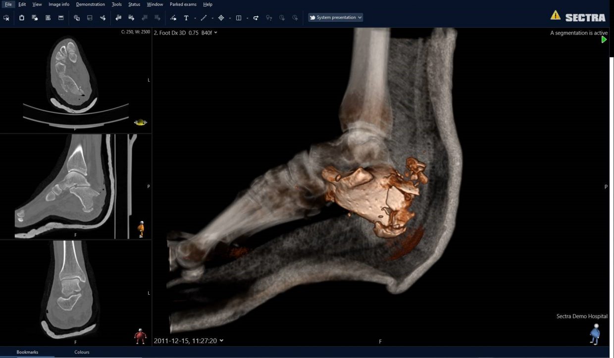Sectra 3D Core integrated in Sectra PACS | Sectra Medical
