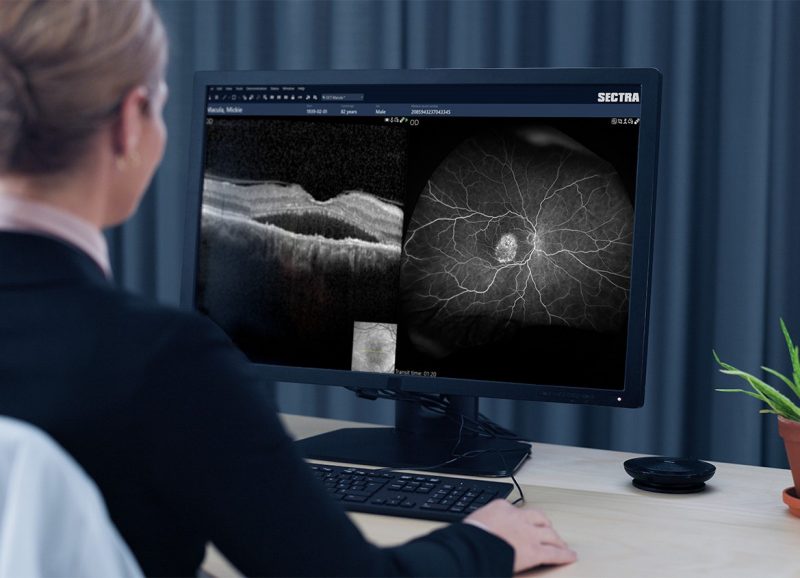 Ophthalmology imaging | Sectra Medical