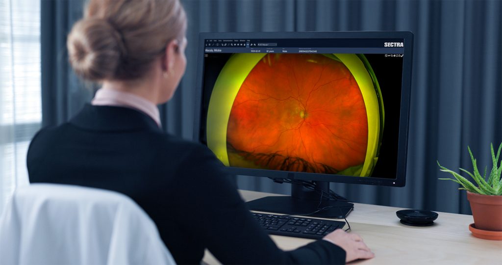 Sectra Ophthalmology Imaging | Sectra Medical