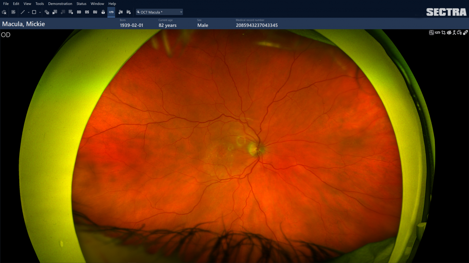 Ophthalmology imaging | Sectra Medical
