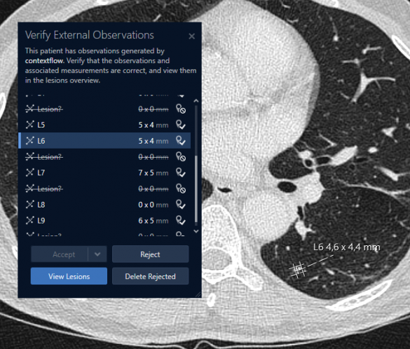 The value of AI is in its integration | Sectra Medical