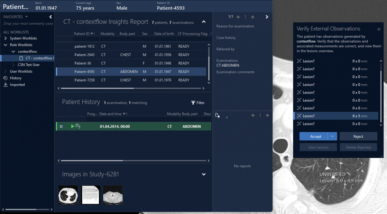 The value of AI is in its integration | Sectra Medical