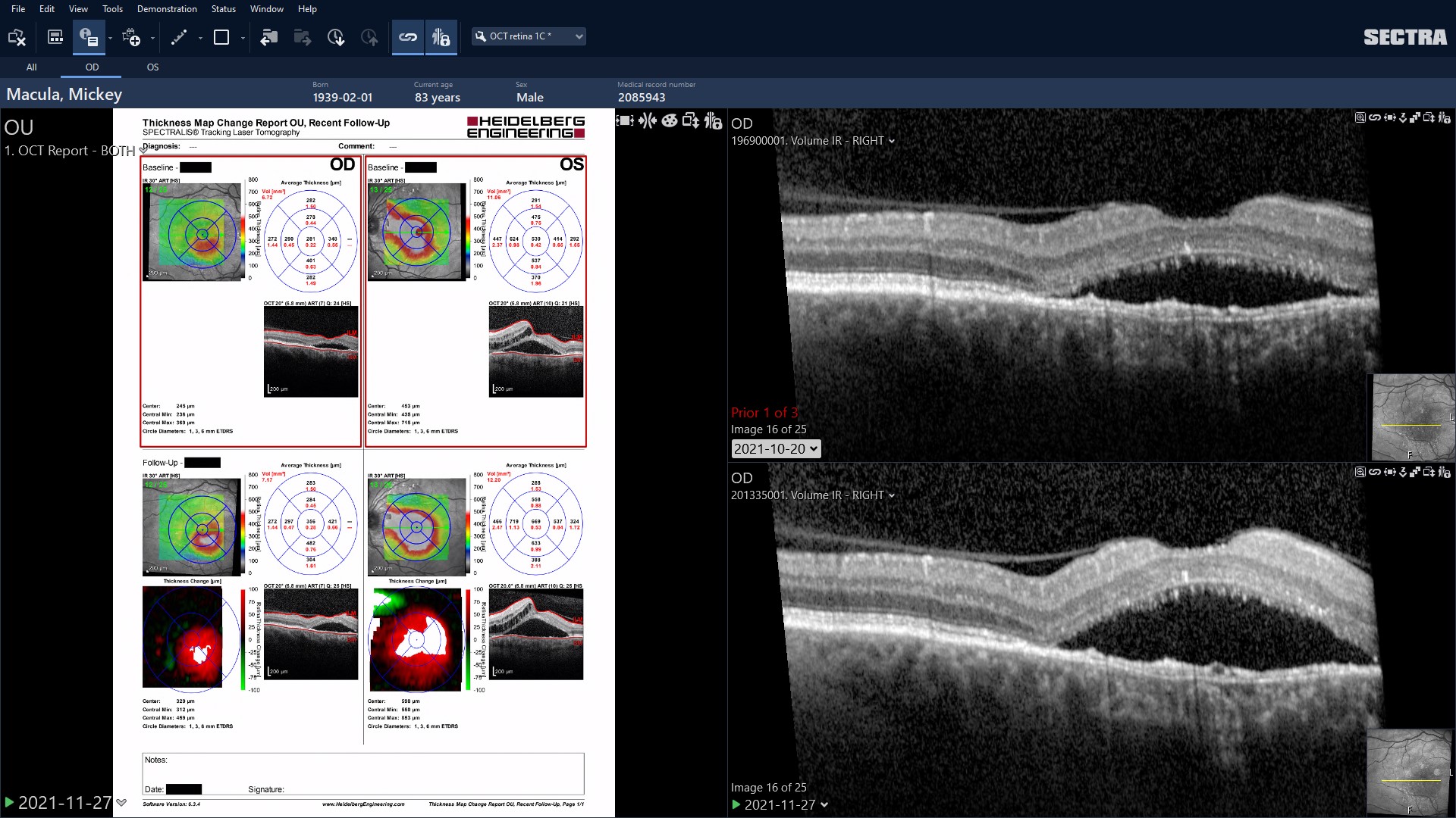 Ophthalmology imaging | Sectra Medical