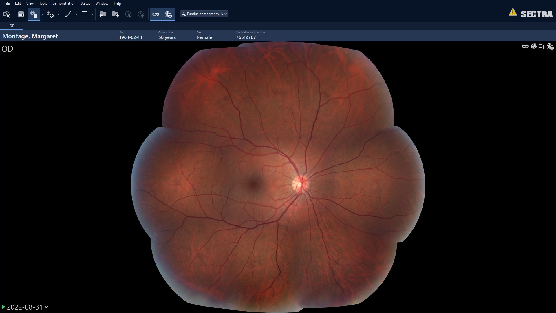 Ophthalmology imaging | Sectra Medical