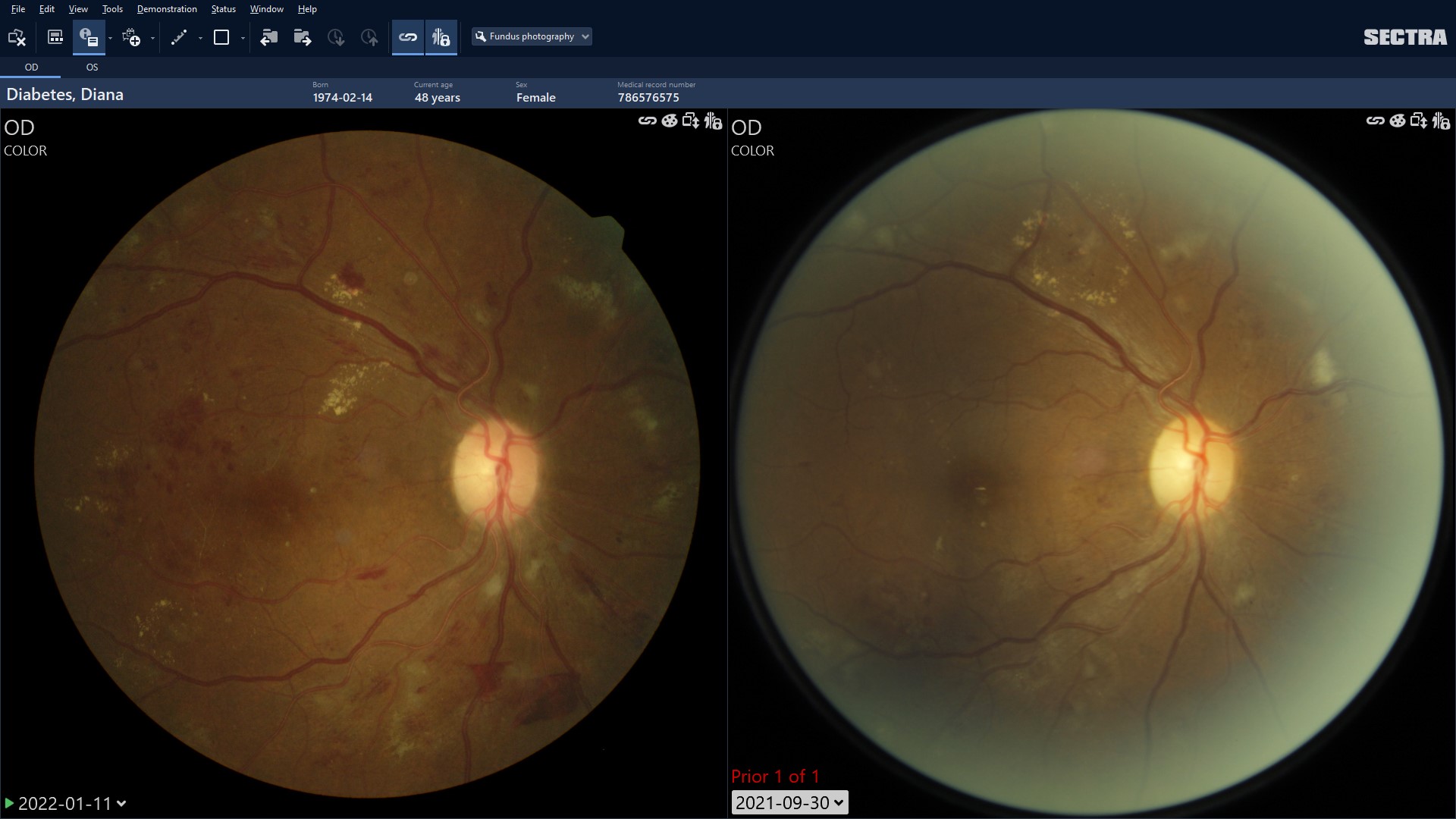 Ophthalmology imaging | Sectra Medical