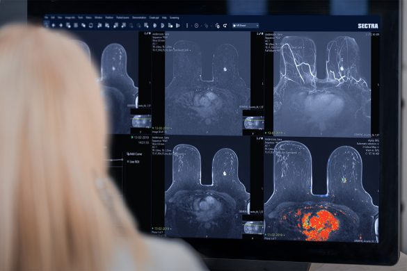 Sectra IDS7 | Sectra Medical